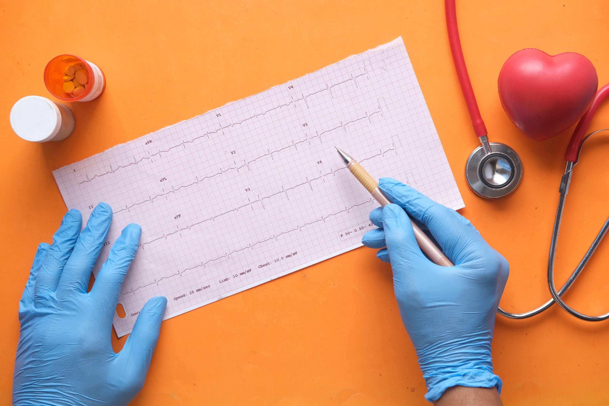 Enfermedades Cardíacas Más Comunes Clínica Alemana Osorno