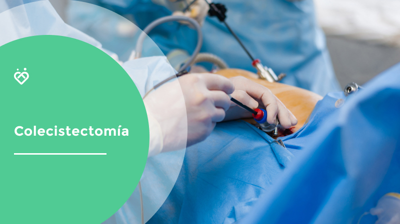 Colecistectomía