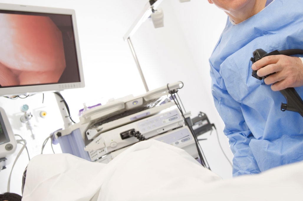 ¿Cuándo se debe realizar una colonoscopía?